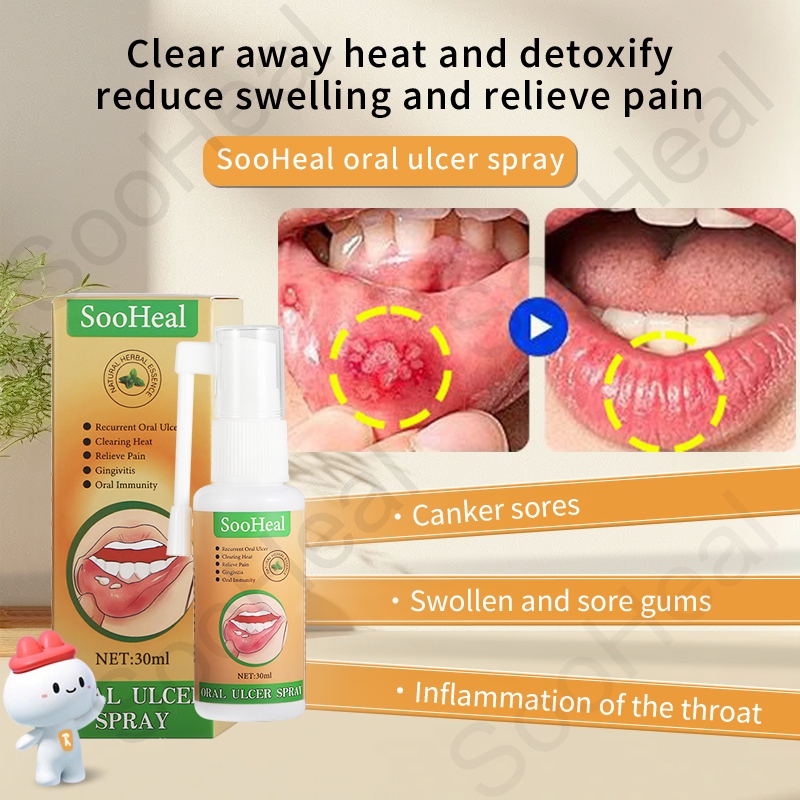 ubat ulser mulut ulser mulut ulcer spray 30ml Bleeding gums bubbles at ...