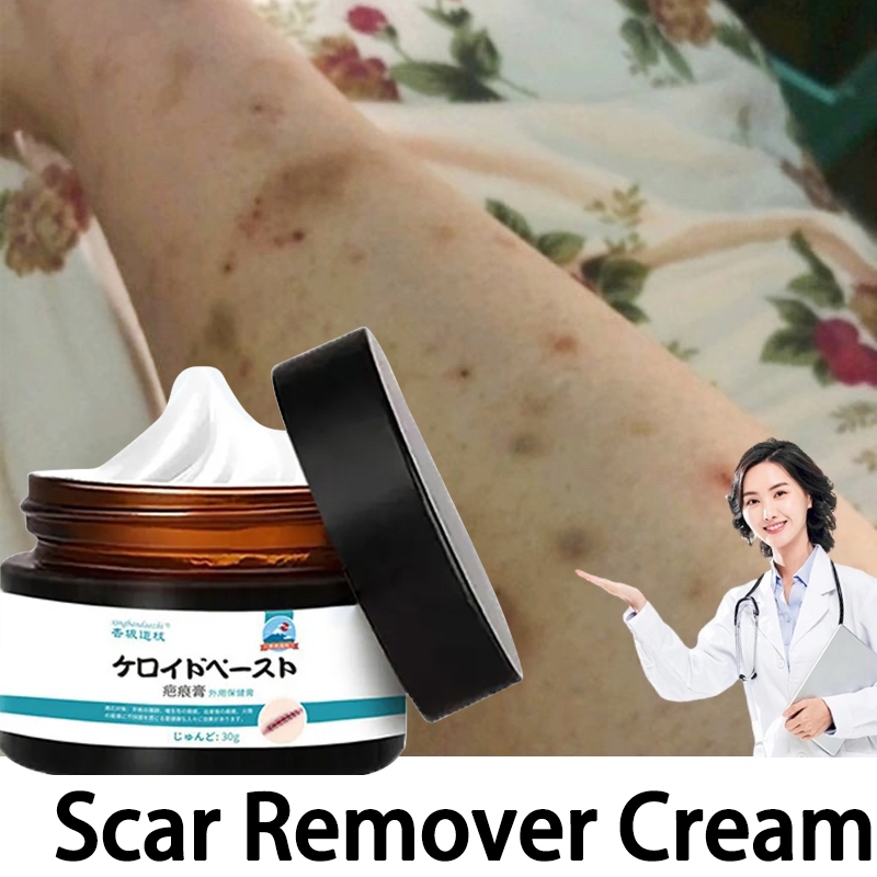 Scar Removal Cream Gel stretch mark cream acne scar treatment hilangkan ...
