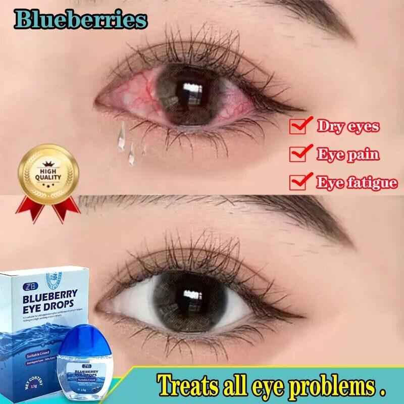 Blueberry eye drops original eye drops 13g relieve dry eyes anti ...