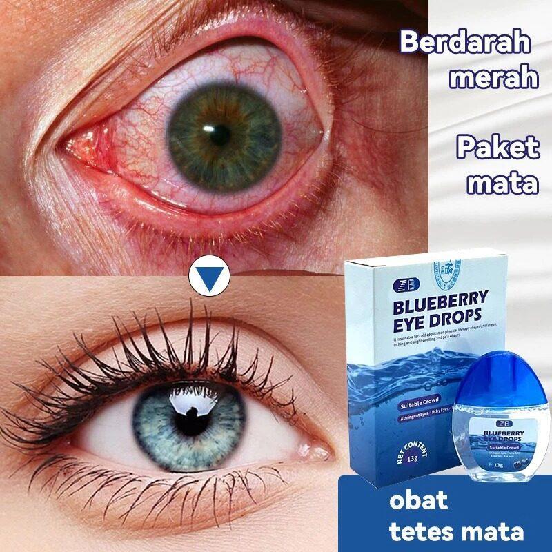 Blueberry eye drops eye drops moisturizing essence relieves eye fatigue ...