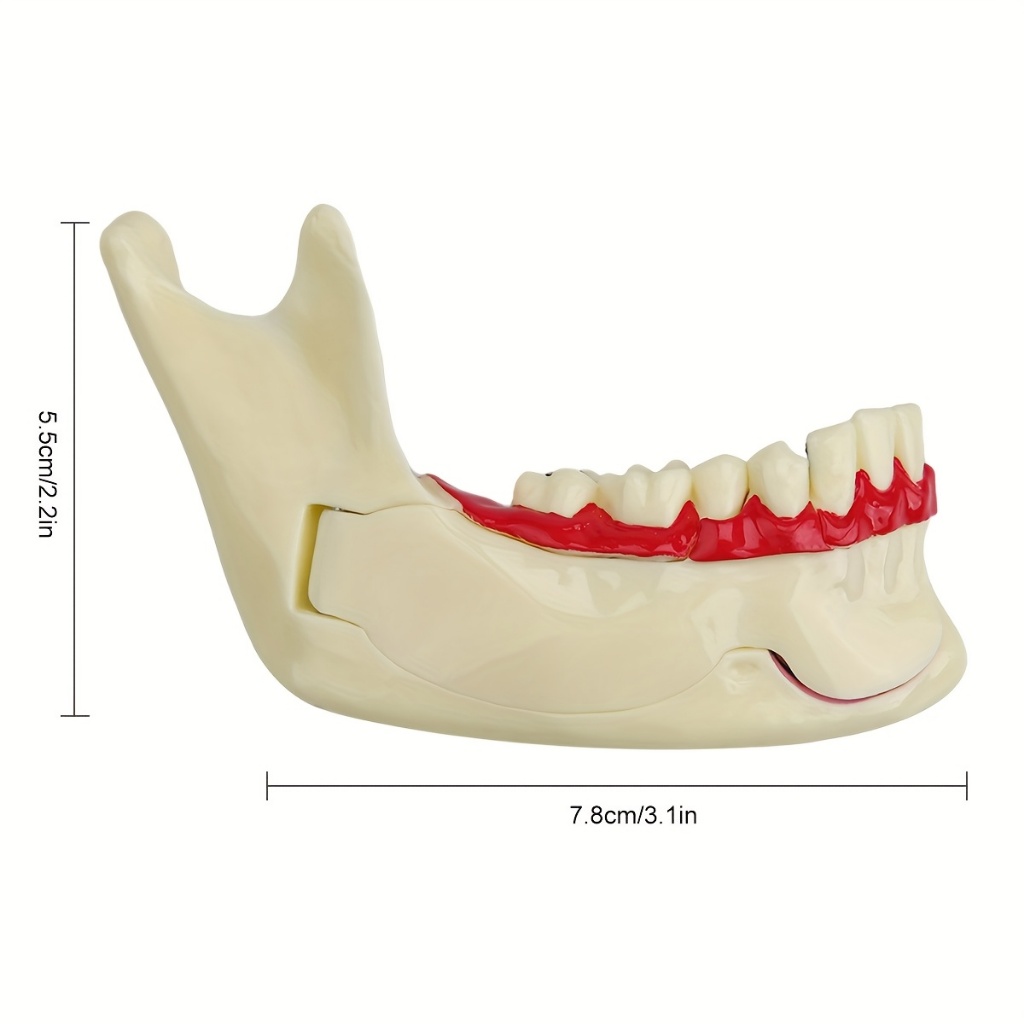 Dental Endodontic Treatment Model Anatomy of Gums Mandible Tissue ...
