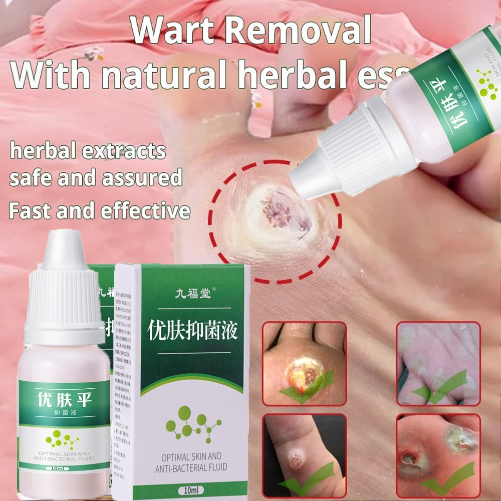 Ubat Ketuat Tapak Kaki Warts Removal Foot Corn Liquid Skin Quick Tag ...