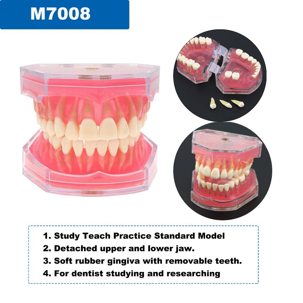 Dental Teeth Model Implant with Removable Dental Education Model for ...