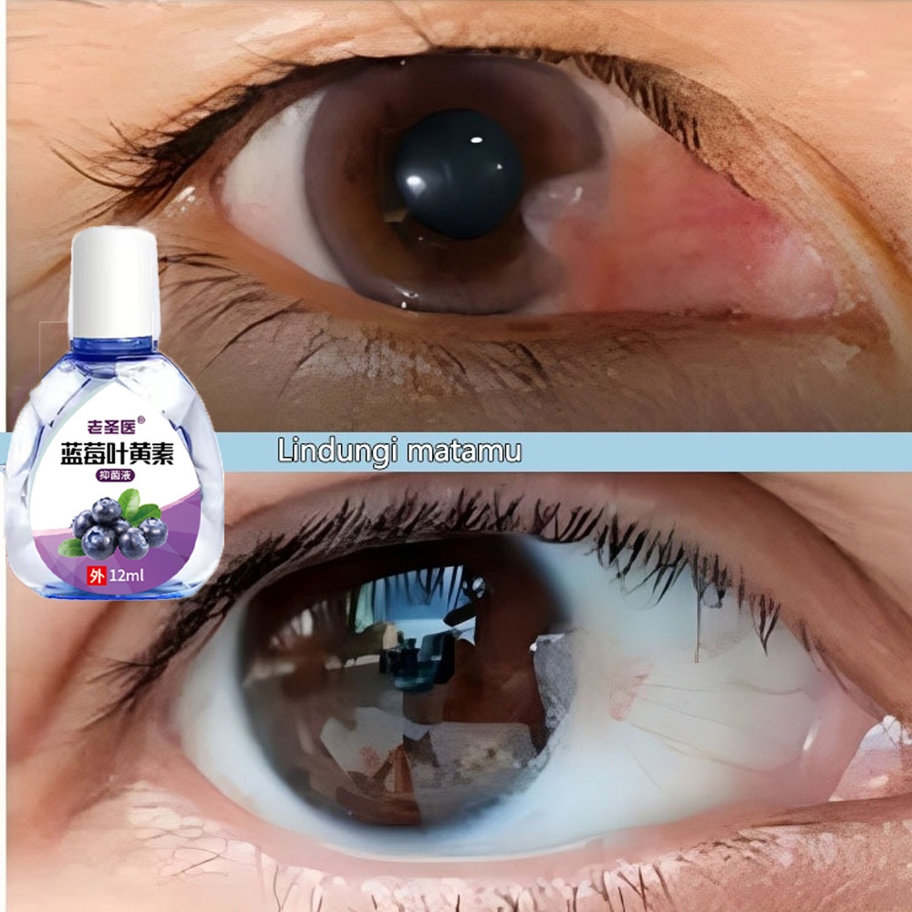 Eye Drops Ubat Mata Rabun Eye drops for dry eye rawatan Mata selaput ...