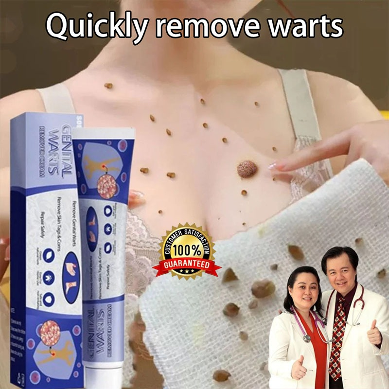 【Fast Effective 】Ubat buang kutil ketuat tahi lalat biji Mole Removal ...