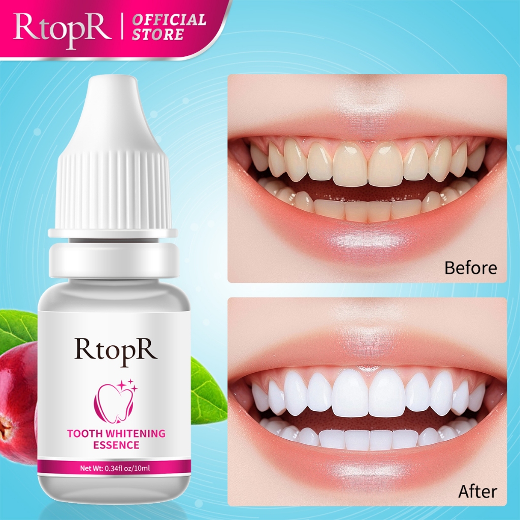 RtopR Teeth Whitening Essence Pemutih gigi Wash Yellow Teeth Remove ...