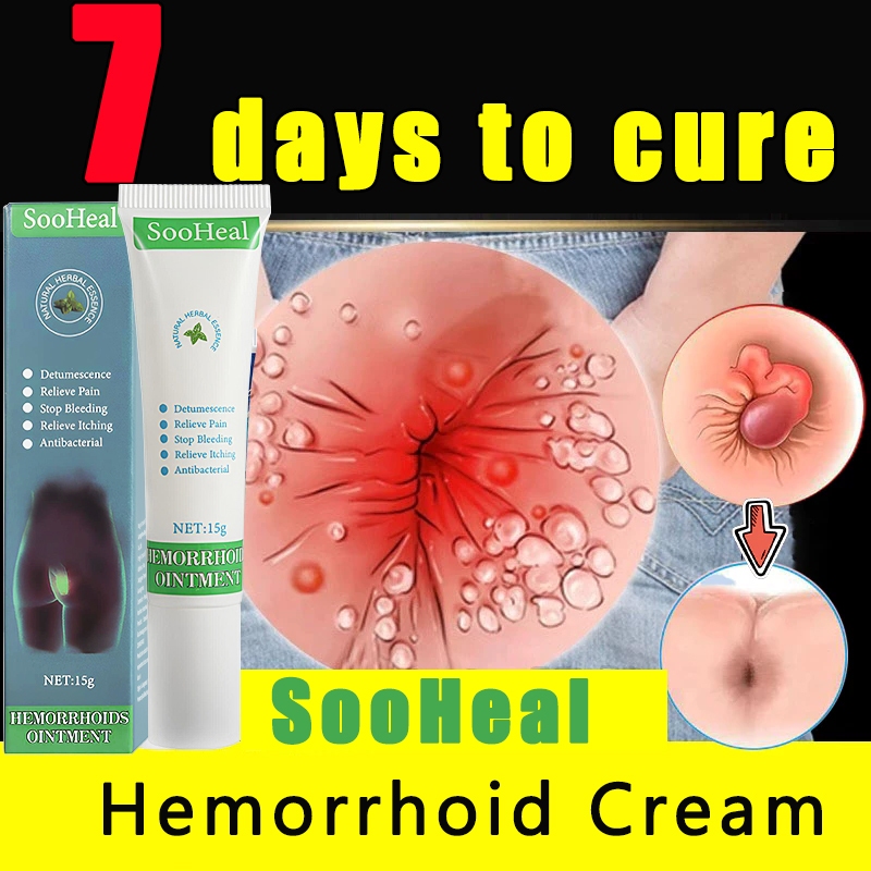 Ubat Buasir Krim buasir Hemorrhoids cream 痔疮膏 100% Original 15G Treatment mixed internal ...