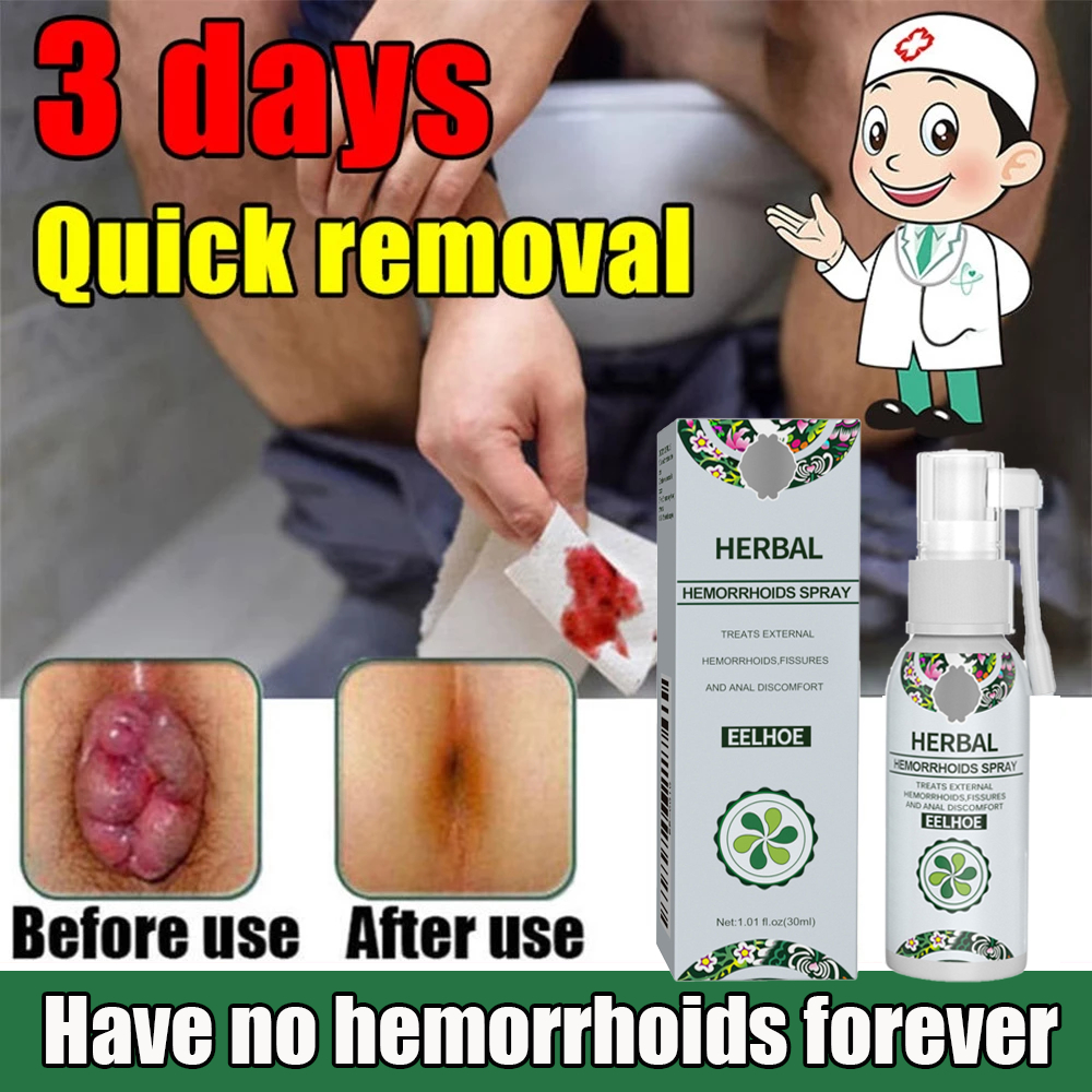 【Official】Hemorrhoids cream Krim Buasir Hemorrhoids spray Treatment of mixed internal and ...