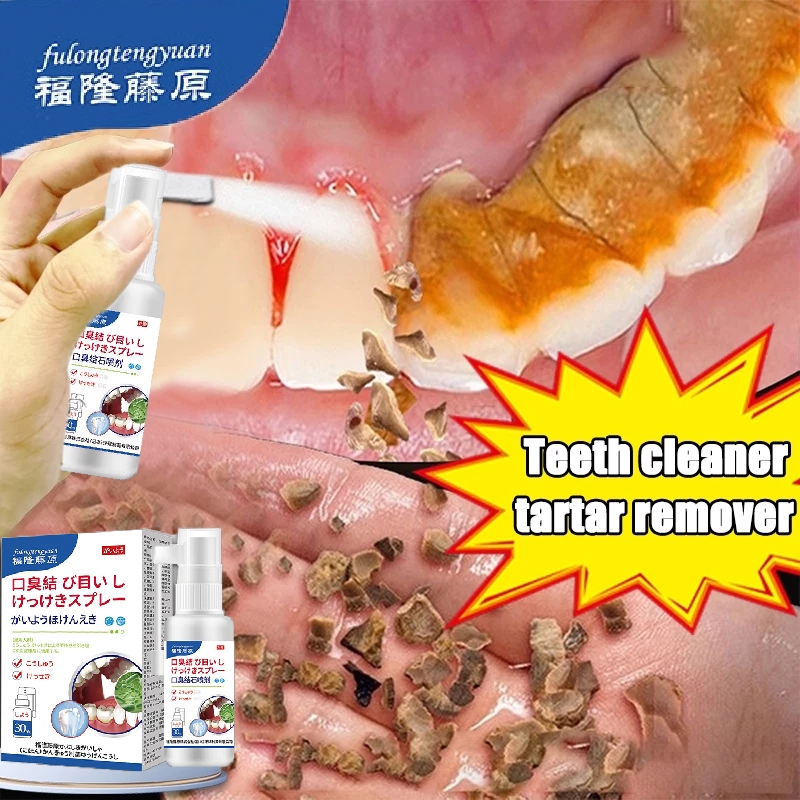 Dental Calculus Dissolving Oral Spray 30ml Tartar Cleaning Spray ...