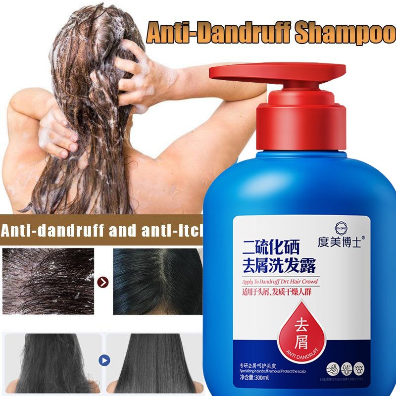 Selenium Disulfide Anti dandruff Shampoo for Hair Care and Psoriasis ...
