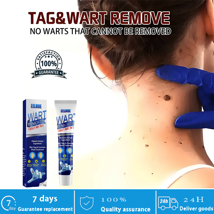 Warts Remover Original Cream Wart Remover Cream 20g Wart Treatment Skin ...