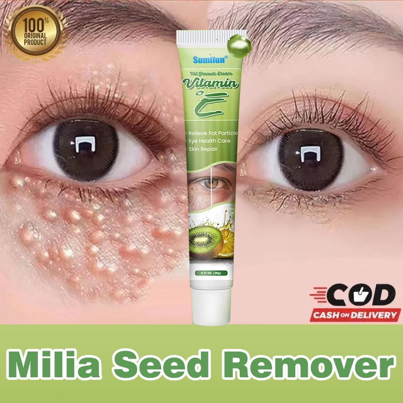 Vitamin E Krim Milia Seed Remover Eye Cream Fat Granule Syringoma Milia ...