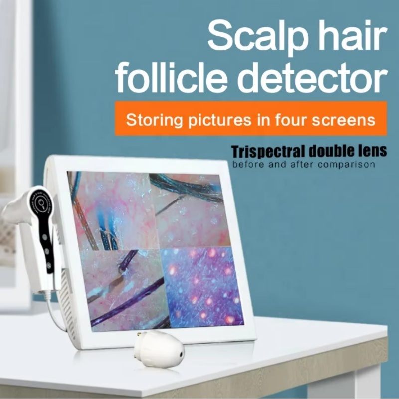 15 Inch Hair Skin Scalp Analyzer Beauty Machine | Shopee Malaysia