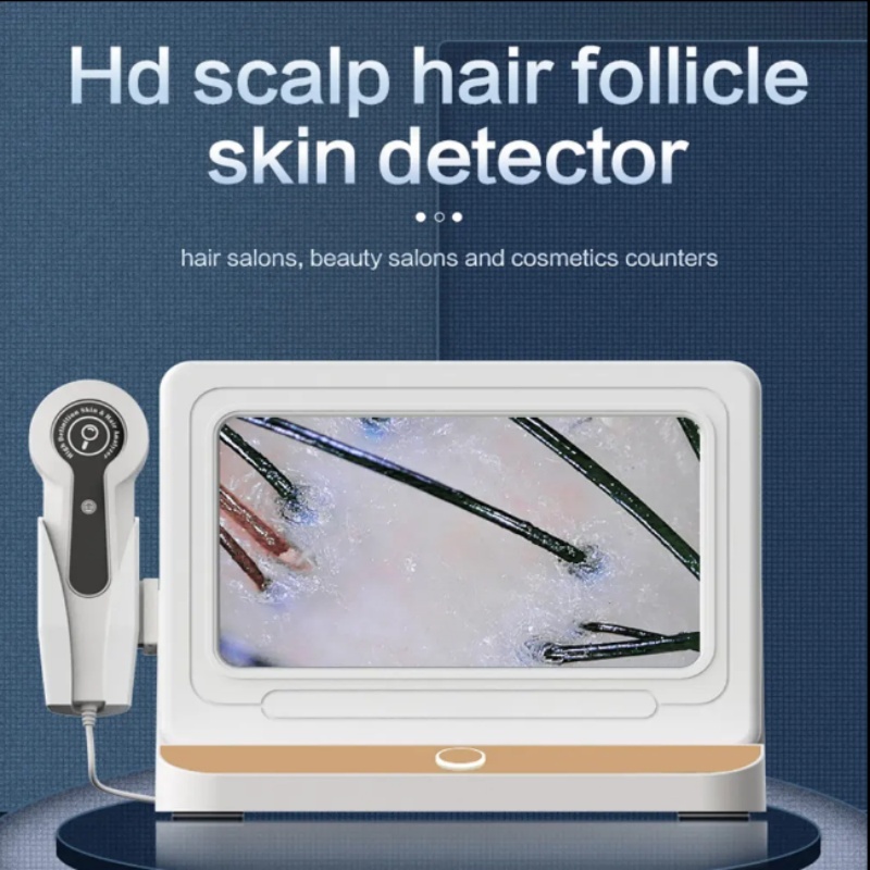 Portable HD Scalp Hair Follicles Scanner Detector Hair Analyzer Home ...