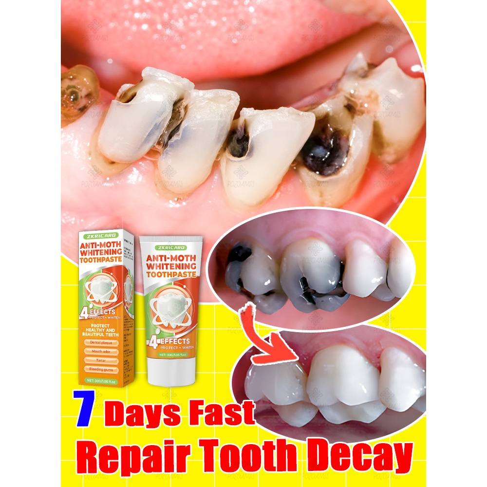 Fluoride toothpaste, prevent tooth decay, fill tooth enamel, no ...