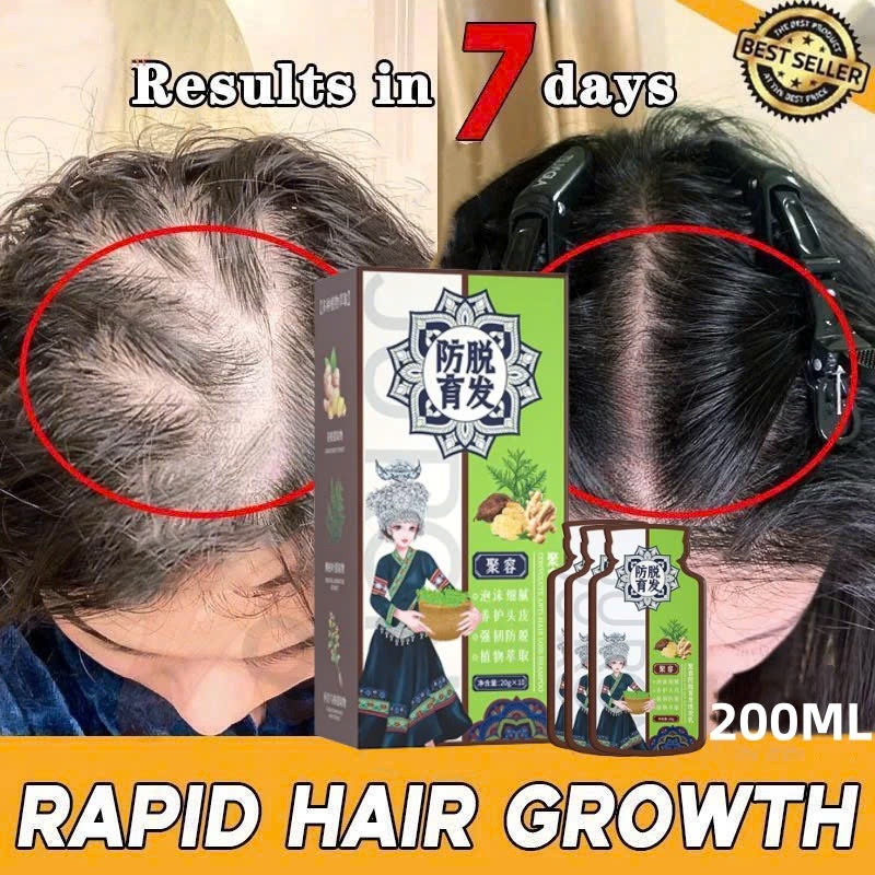 DHT Herbal Shampoo Effective Solution For Hair Loss, Fast Hair Growth, Dandruff & Scalp Fungus ...