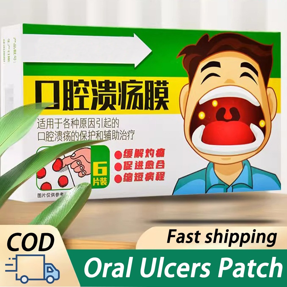 Mouth Ulcer Patch 6 pieces For all kind of oral & canker ulcers Oral Ulcer Patch for Ulcer ...