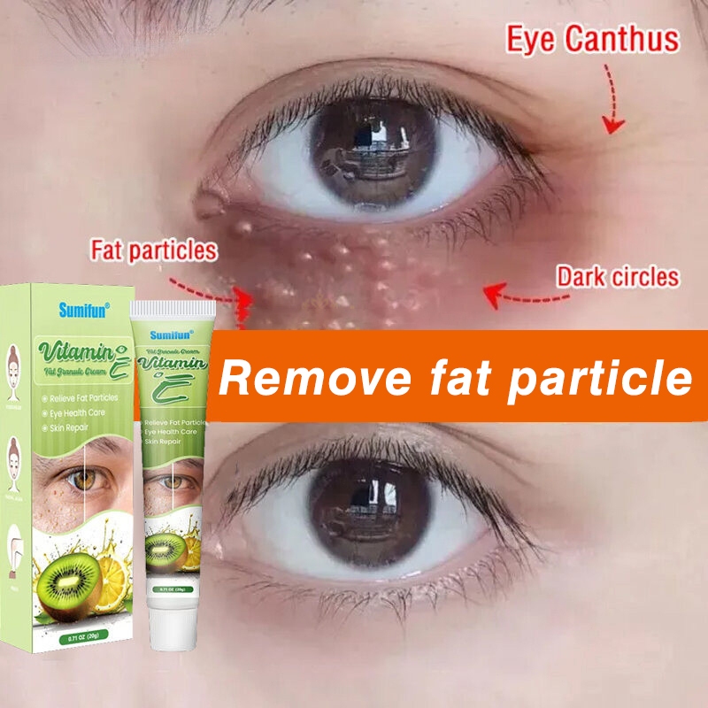 Vitamin E eye Milia Seed Remover Eye Health Fat Granule Syringoma Milia ...