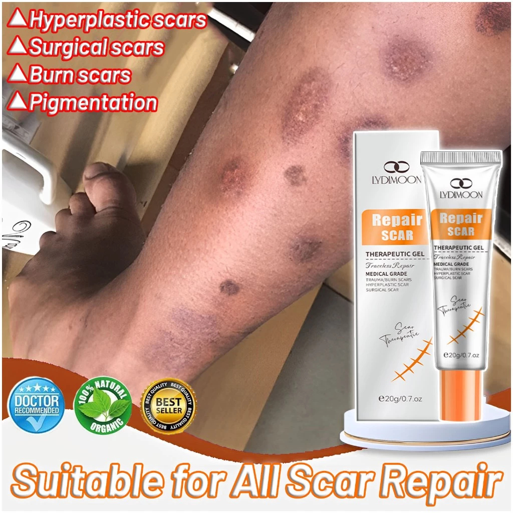 scar removal cream 20g acne scar removal scar gel Treatment Remove ...
