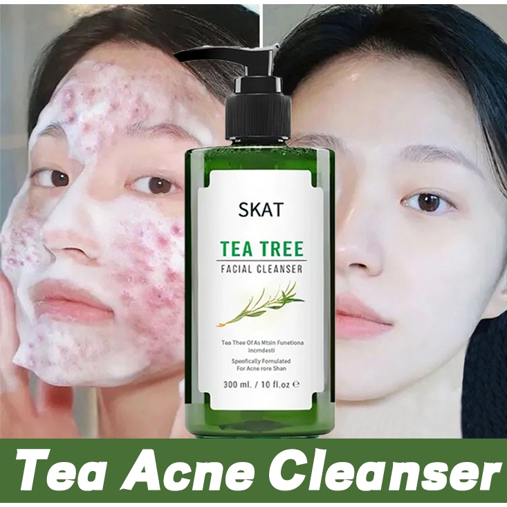 Tea Tree Facial Cleanser Control Deep Clean Foam Whitening Amino Acid ...