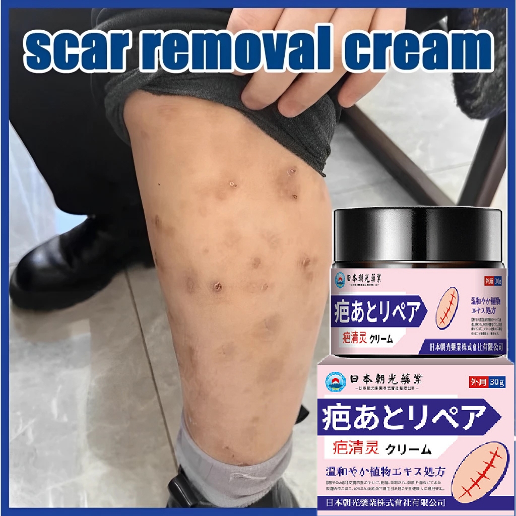 Japan Scar Repair Cream Krim Anti Stretch Mark Cream Burns Old Scars ...