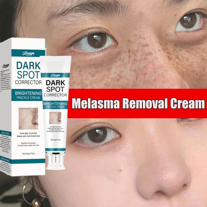 Hot selling Melasma cream pekas remover Original Collagen pekas cream ...