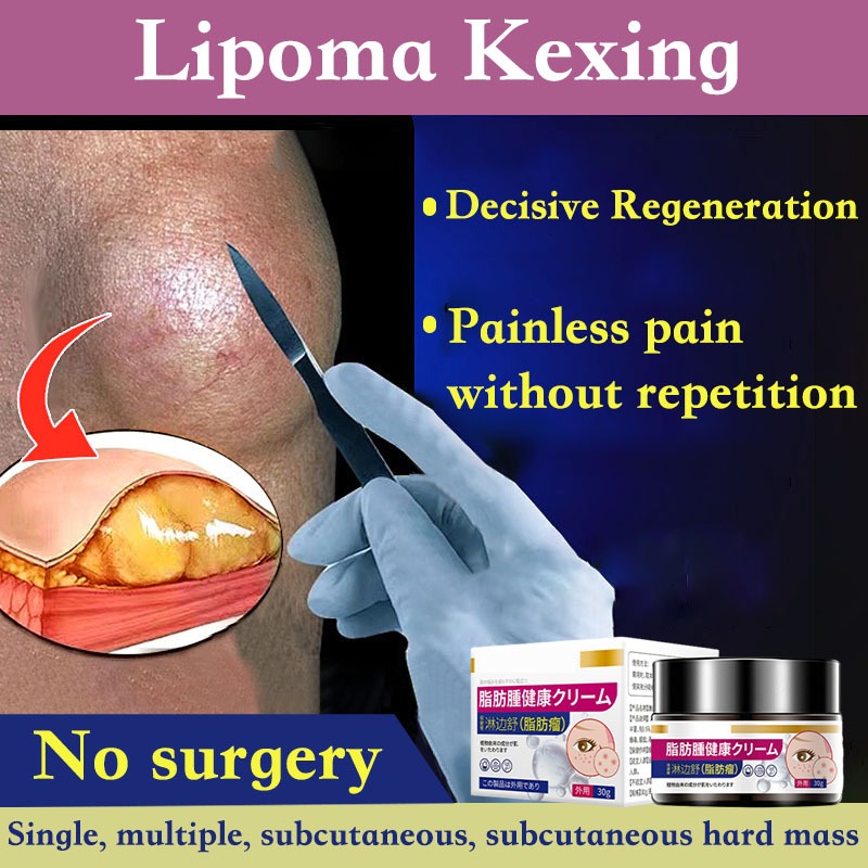 【New Product Discounts】lipoma removal cream original Subcutaneous ...