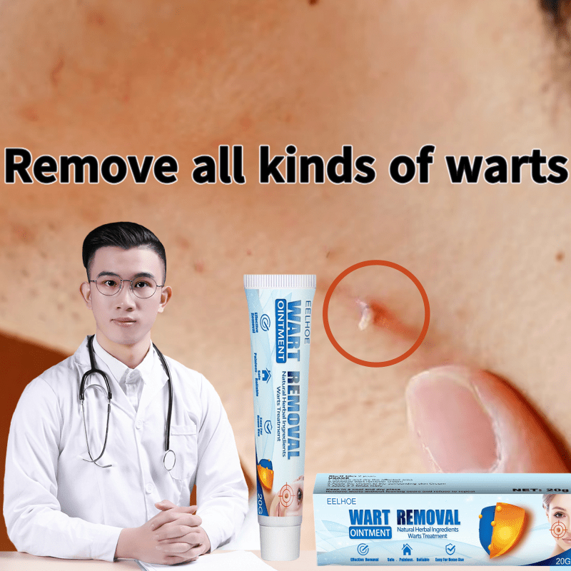 Warts Remover Original Cream Wart Remover Ointment Wart Treatment Skin ...