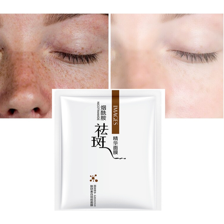 10pcs/box Whitening Mask Nicotinamide Dark Spot Melasma Remover Anti ...