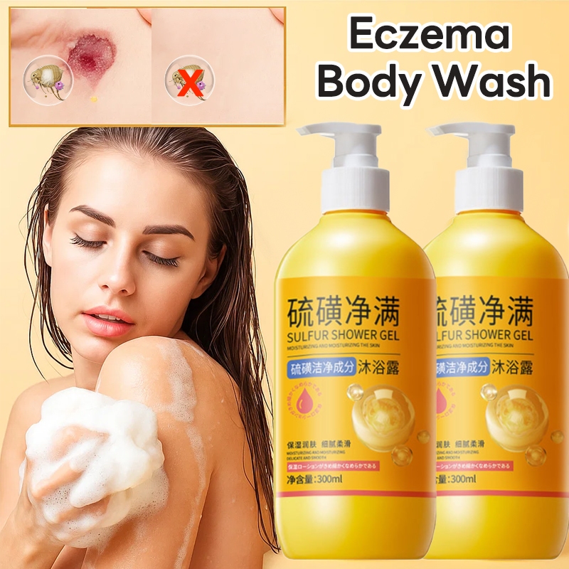 Sulfur Mite Removal Shower Gel Eczema Body Wash Antibacterial Acne for Cleaning Moisturizing ...