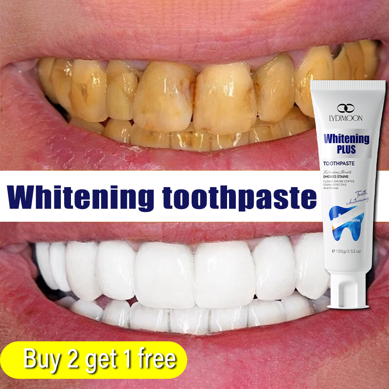 whitening toothpaste 100g removes tea stains smoke stains tartar ...