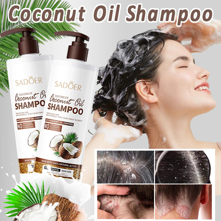 Coconut Oil Shampoo Anti-dandruff Kelemumur Ubat Oil Control Anti Itching Scalp Treatment ...