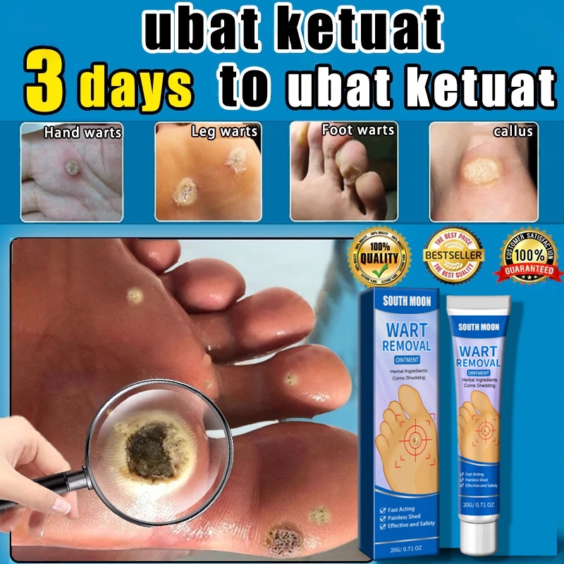 【Hot selling】Ubat Ketuat Tapak Kaki Ubat Mata Ikan Penampal Ketuat ...