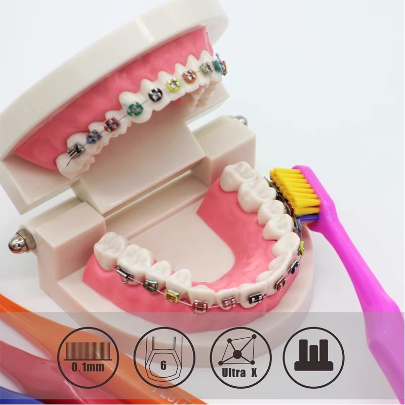 PESITRO - 𝗨𝗹𝘁𝗿𝗮𝘀𝗼𝗳𝘁 Ultra Clean Toothbrush - 6580 Ortho | Shopee Malaysia