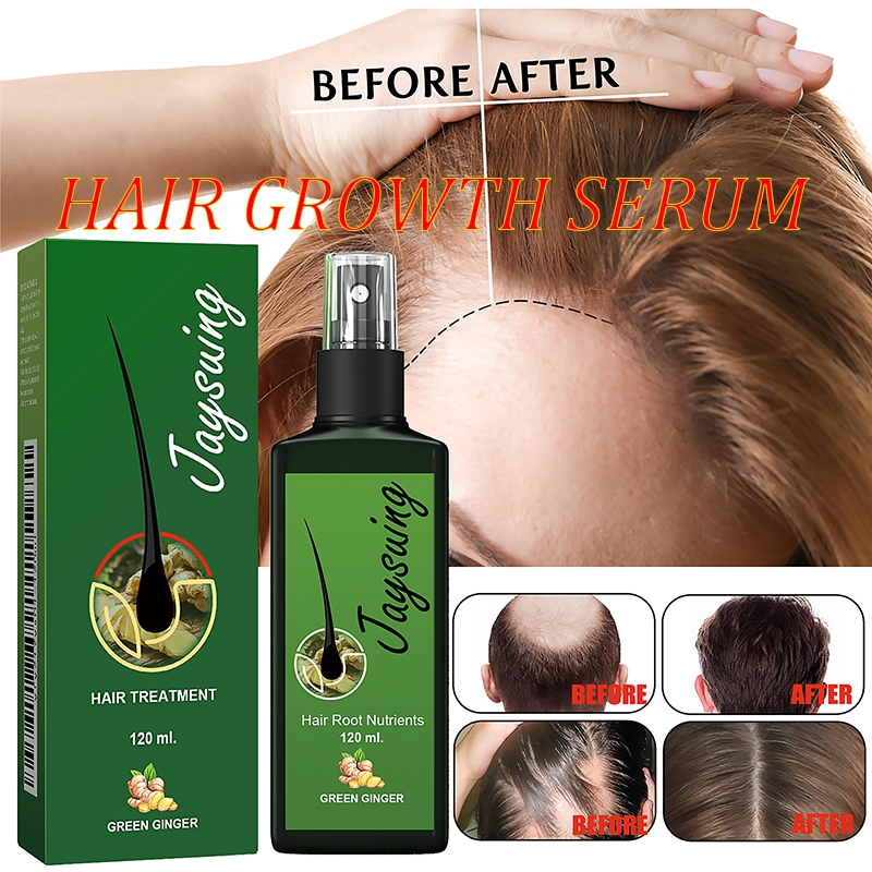 Hair Growth Treatment, Anti Hair Loss Promotes Thicker Hair Conditioner ...