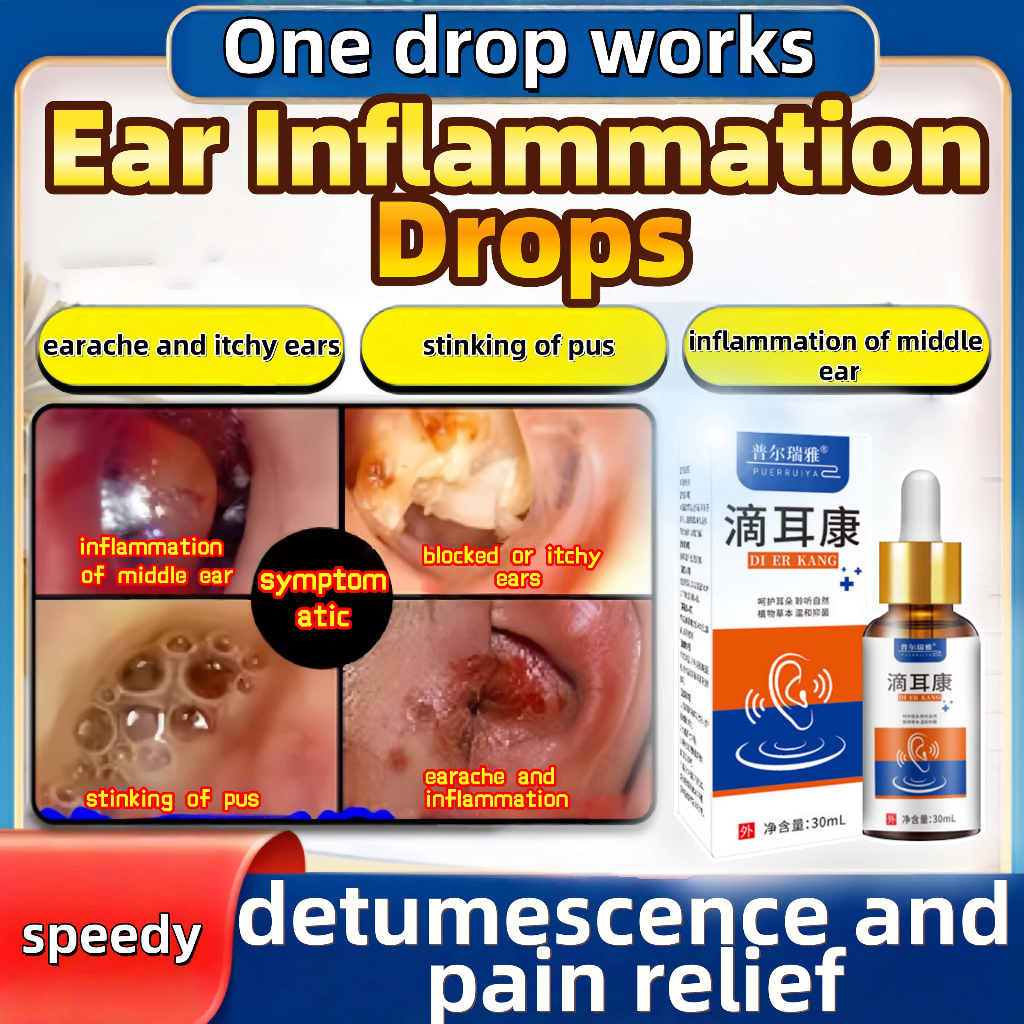 Ear drops are used to treat fungal otitis media and fungal otitis ...