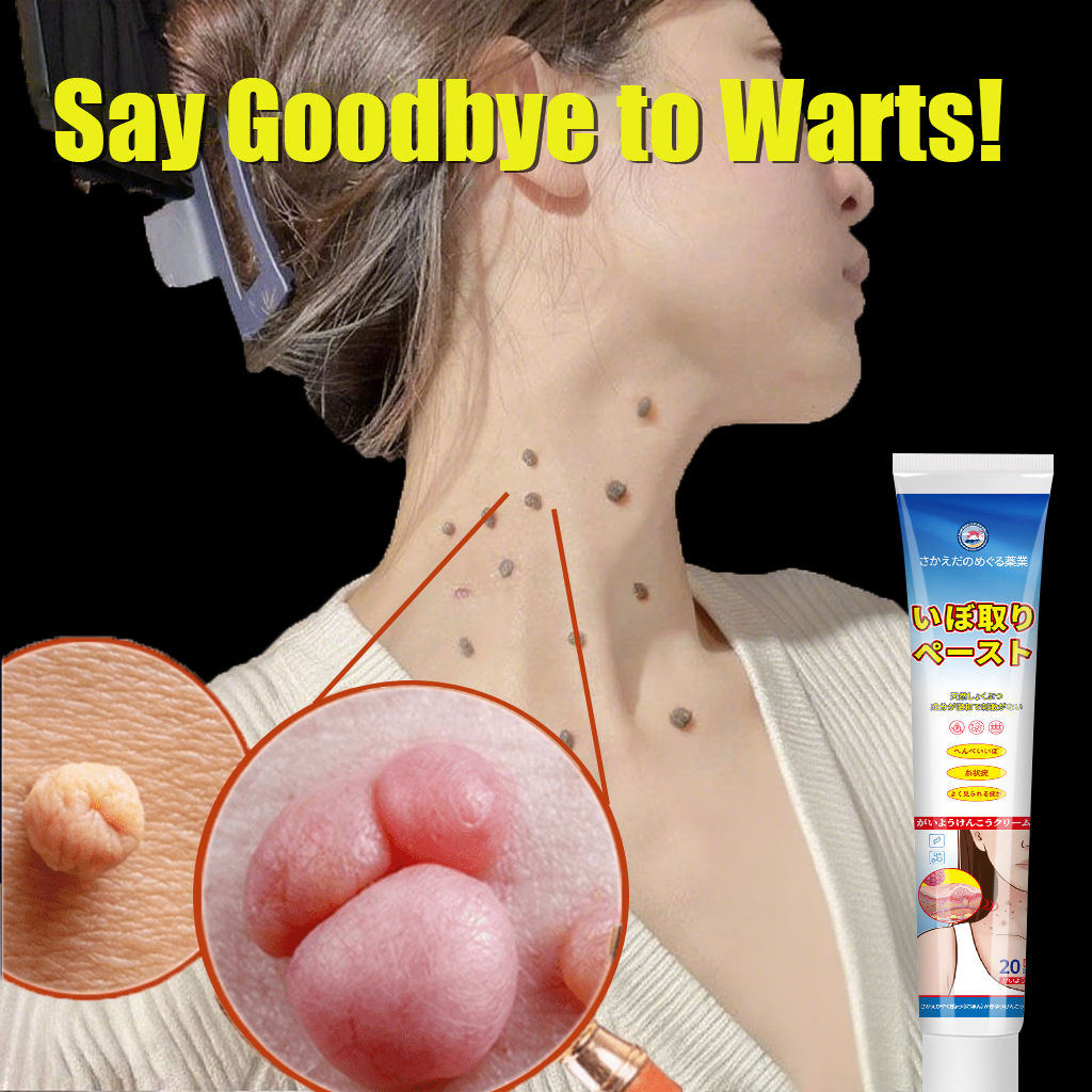 Herbal Wart Removal Cream - Painless for Moles, Flat/Plantar/Genital Warts | Fast-Acting ...