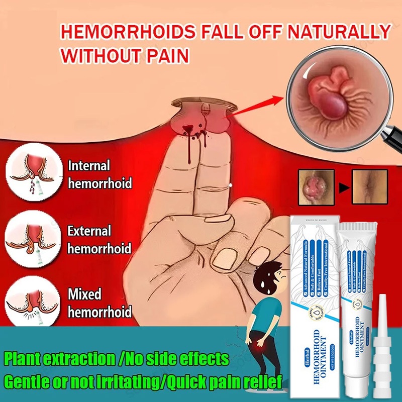 Hemorrhoid Cream Ubat Buasir 100% Berkesan Herba Cina Krim Buasir Relieve Pain, Itching ...