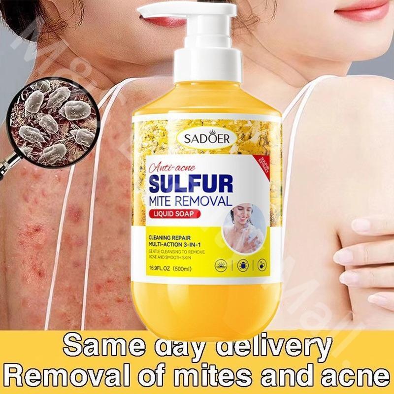 Acne Removal Body Wash Sulfur Antibacterial Body Wash Anti Mite Shower ...