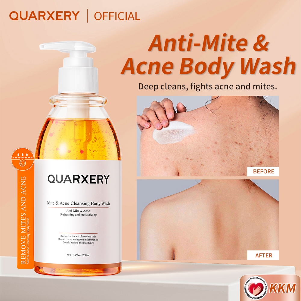 Quarxery Shower Gel Acne&Mite Cleansing Body Wash Mite Removal&Acne Removal Shower Gel ...