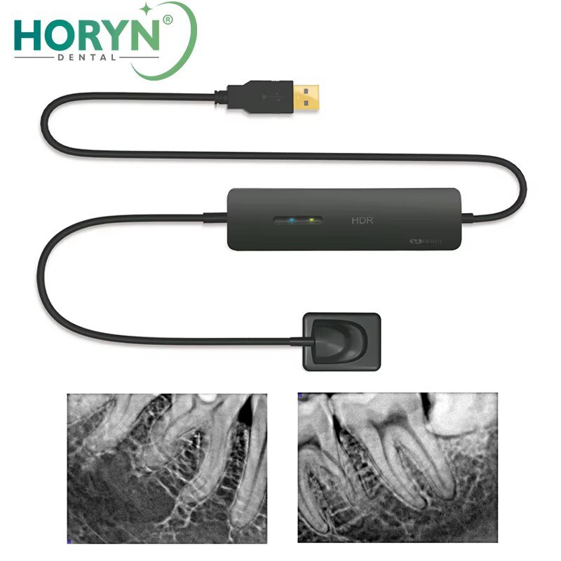 Dental x ray Sensor Digital RVG with Intra Oral Xray Sensor HDR 500 ...