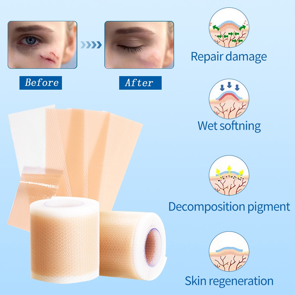 Silicone Scar Tape Surgical Scar Removal Scar Away Patch Lighten ...