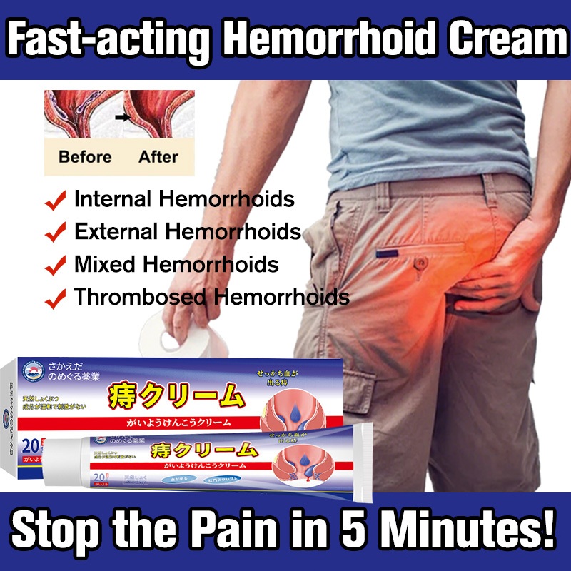 Hemorrhoid Cream Ubat Buasir Relieves Pain Itching Swelling Bleeding ...
