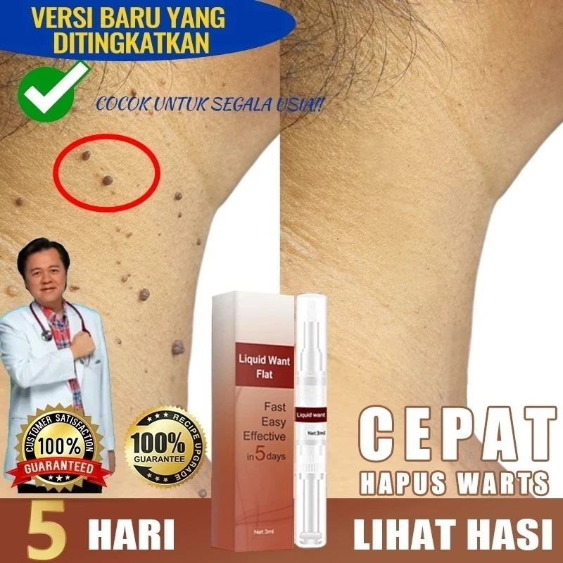 Original Ubat ketuat Tahi lalat Remover Warts Treatment Cream Skin Tag ...