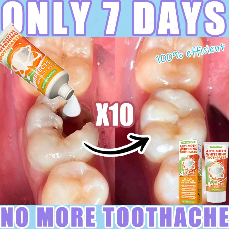 【Local Seller】Fluoride repair toothpaste, prevent tooth decay, fill ...