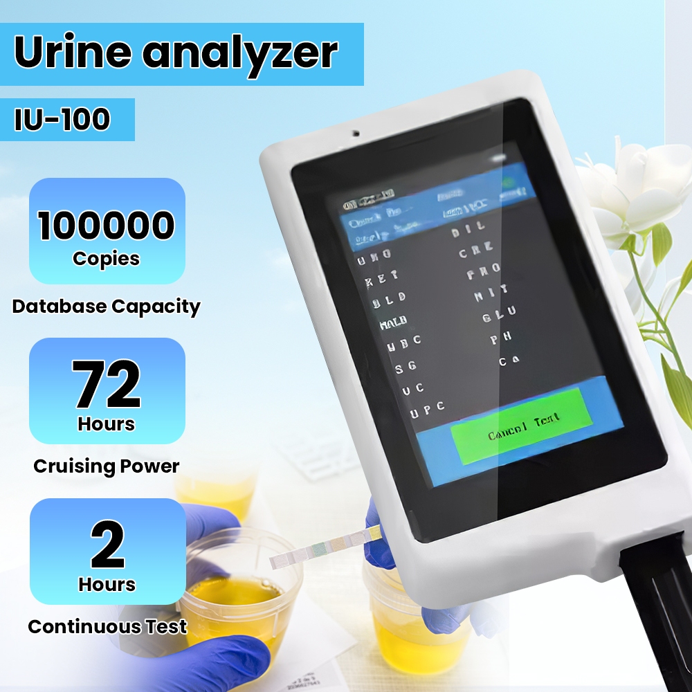 IU-100 URINE Routine ANALYZER Hospital Portable urinalysis test machine ...