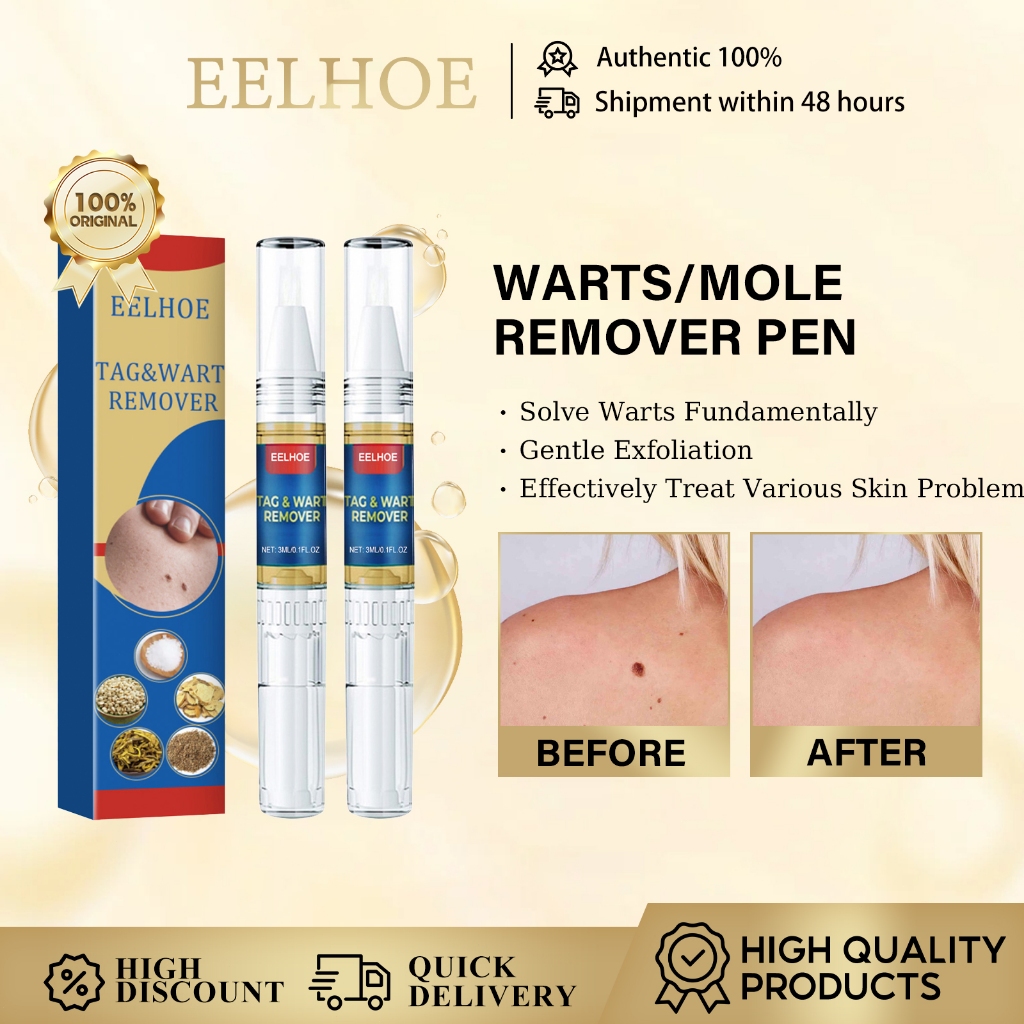 Eelhoe Warts Remover Pen Mole Remover Pen Skin Tag Remover Pen Skin ...