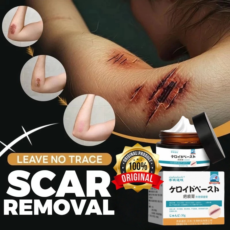 ⭐COD ORI⭐Japan Scar Removal Cream Krim Hilangkan Parut Hitam Luka Lama ...