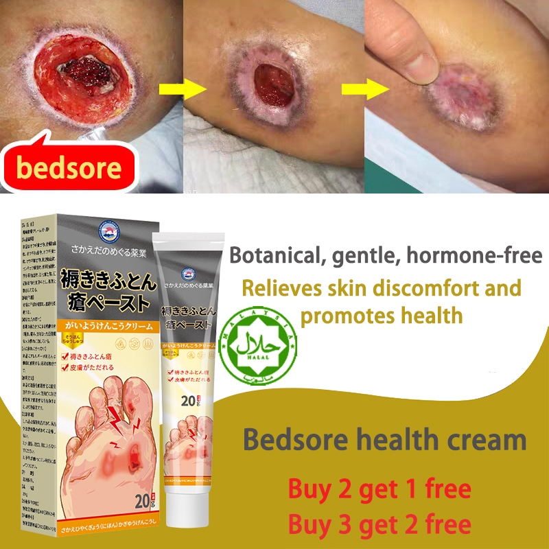 Bedsore Treatment Cream ulcer medicine ubat luka Pressure Sore Ulcer ...