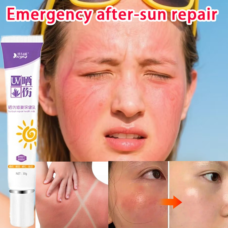 After Sun Soothing Cream sunscreen Skin sunburn repair cream 30g ...